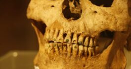 Antik Maya Uygarlığı Diş Çürükleri ile Mücadele Ediyordu